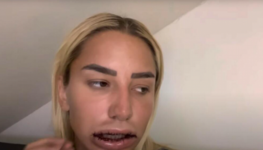 Oglasila se Aleksandra Nikolić nakon operacije, pa podelila jezive slike sa svojim fanovima ...