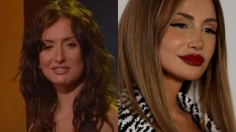 Emina Jahović pre operacija - Alo.rs