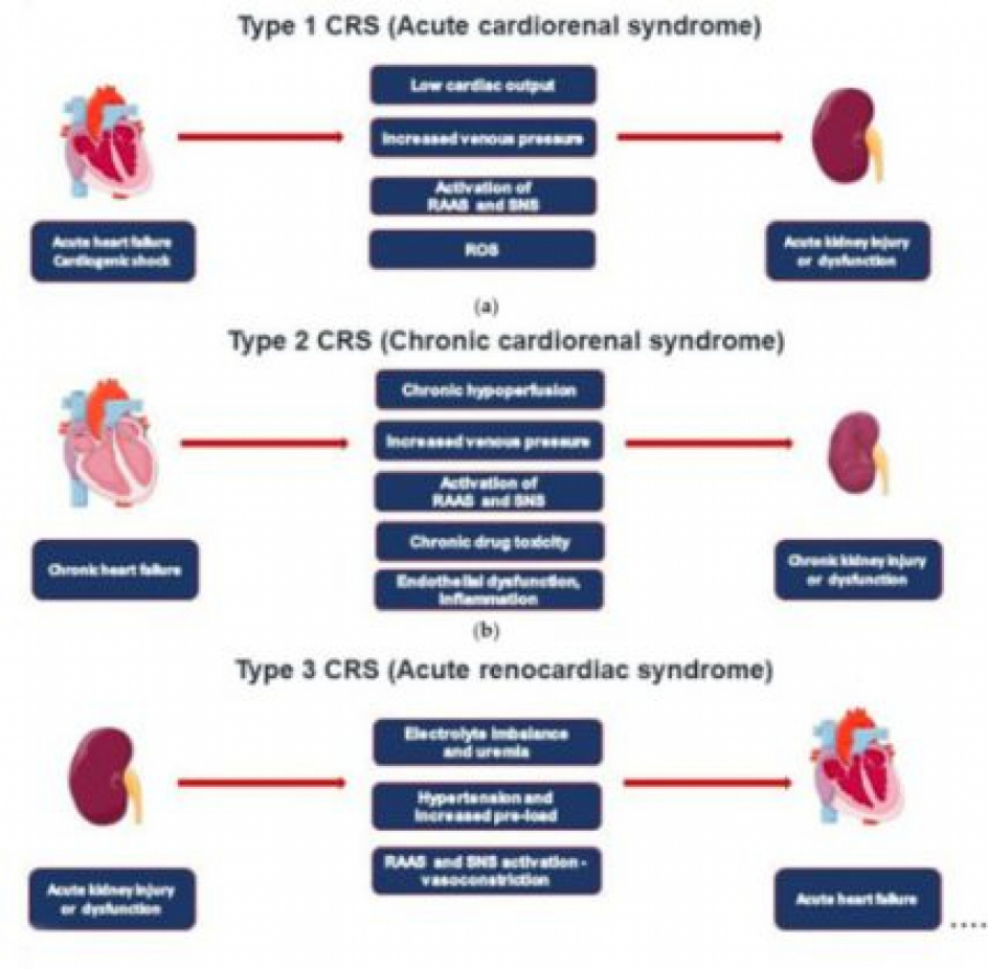 PREVENCIJA JE KLJUČ ZA ZDRAVLJE Kako prepoznati KARDIO-RENALNI SINDROM, evo šta su rekli ...