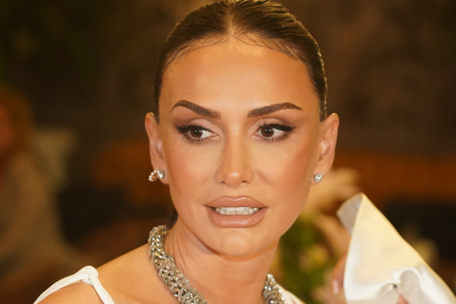 Emina Jahović pre operacija - Alo.rs